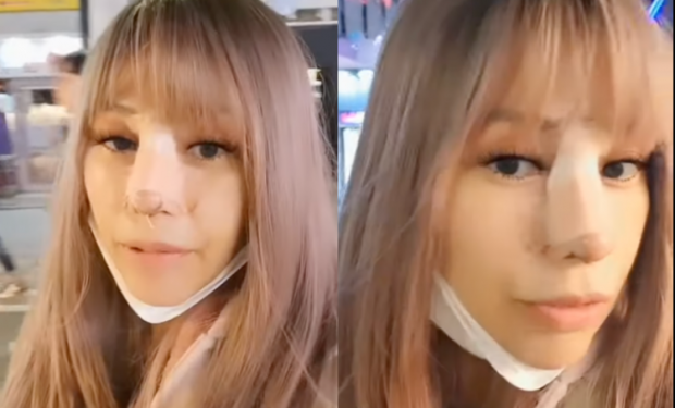 Lana Nodin Selesai Jalani Pembedahan Hidung Di Korea Selatan