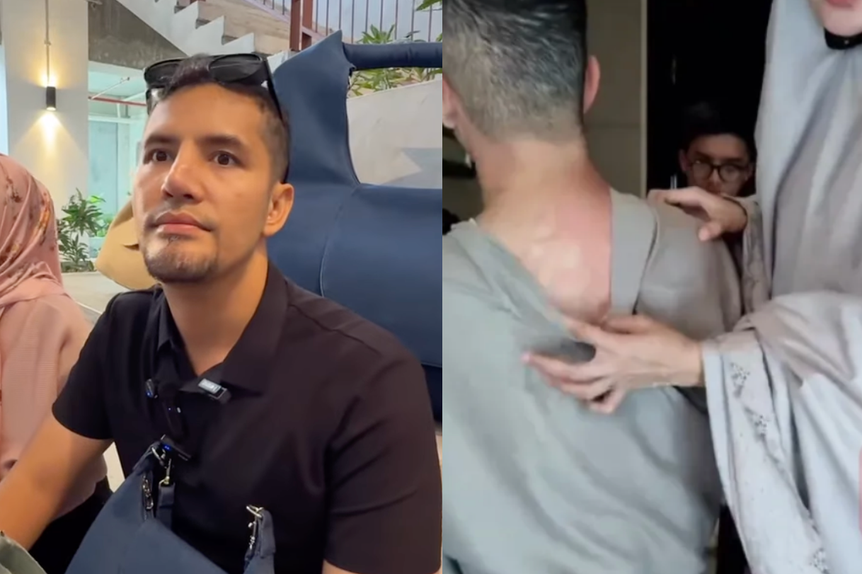 Badan Penuh Tompok Merah, Aliff Syukri Syak Kena ‘Jilat Jin’